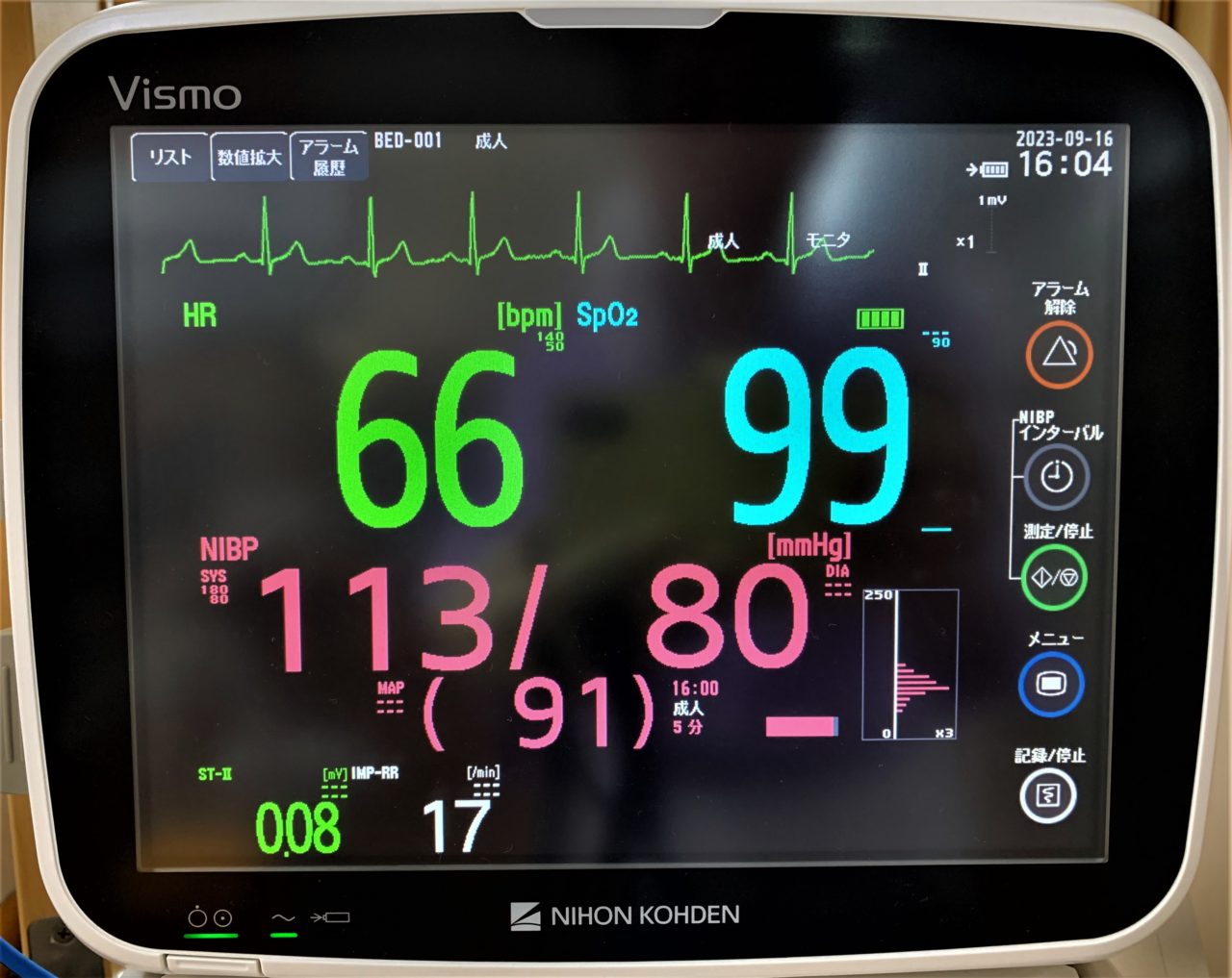 生体情報モニタ 導入しました｜広島市の矯正歯科「医）アルパーク歯科・矯正・栄養クリニック」