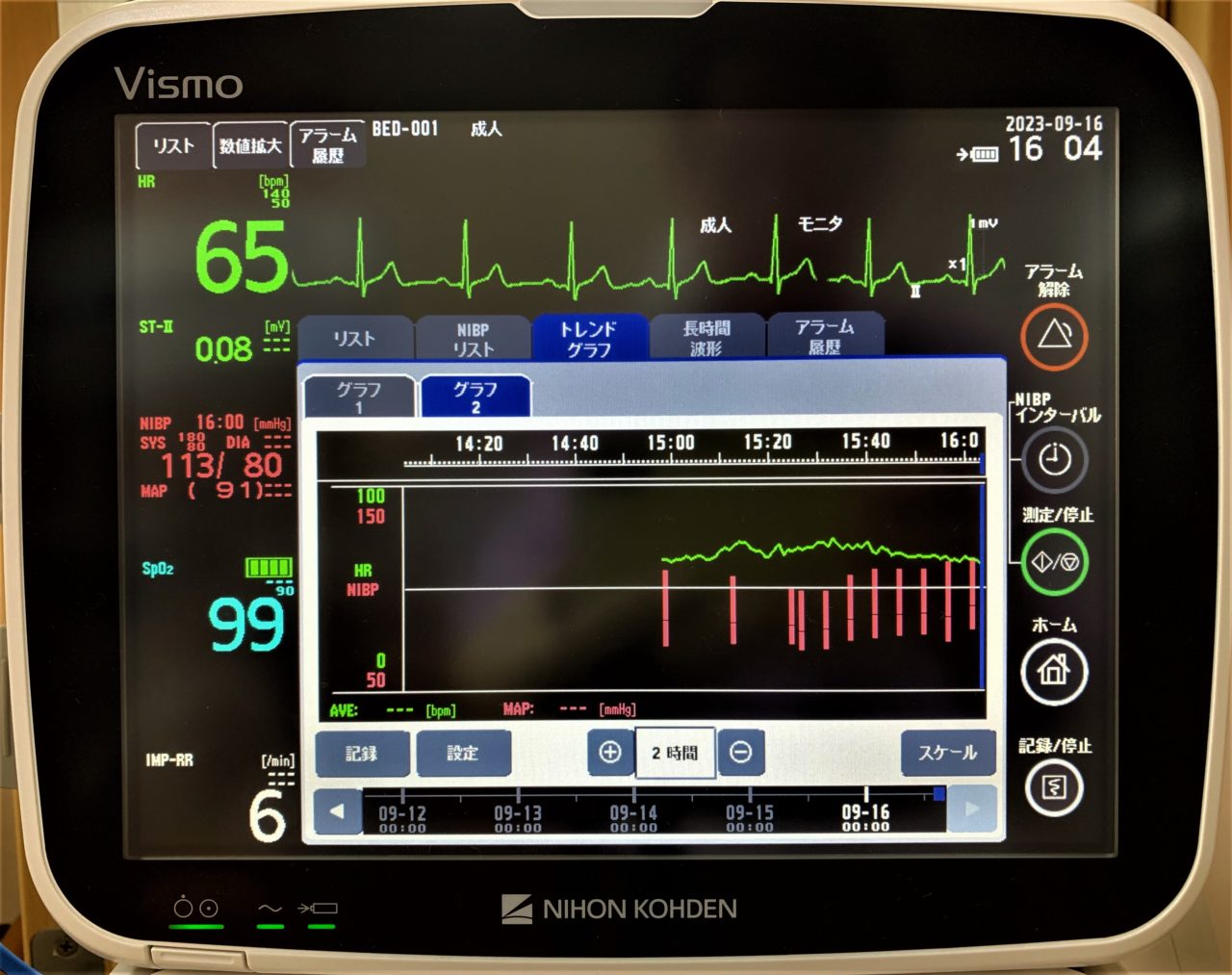 生体情報モニタ 導入しました｜広島市の矯正歯科「医）アルパーク歯科・矯正・栄養クリニック」